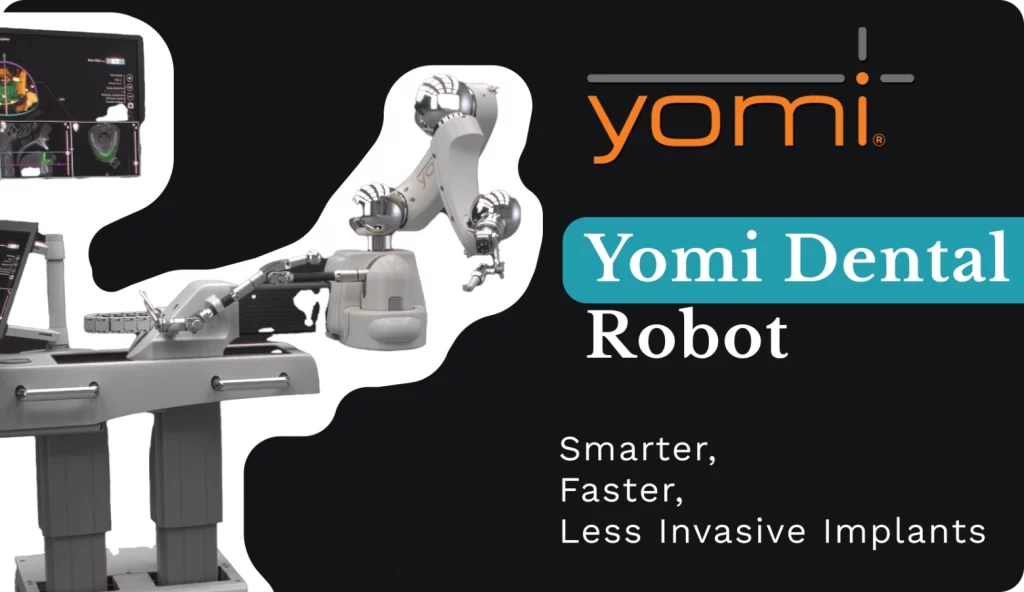 Dental Implants with Yomi Implant Robot: What to Know